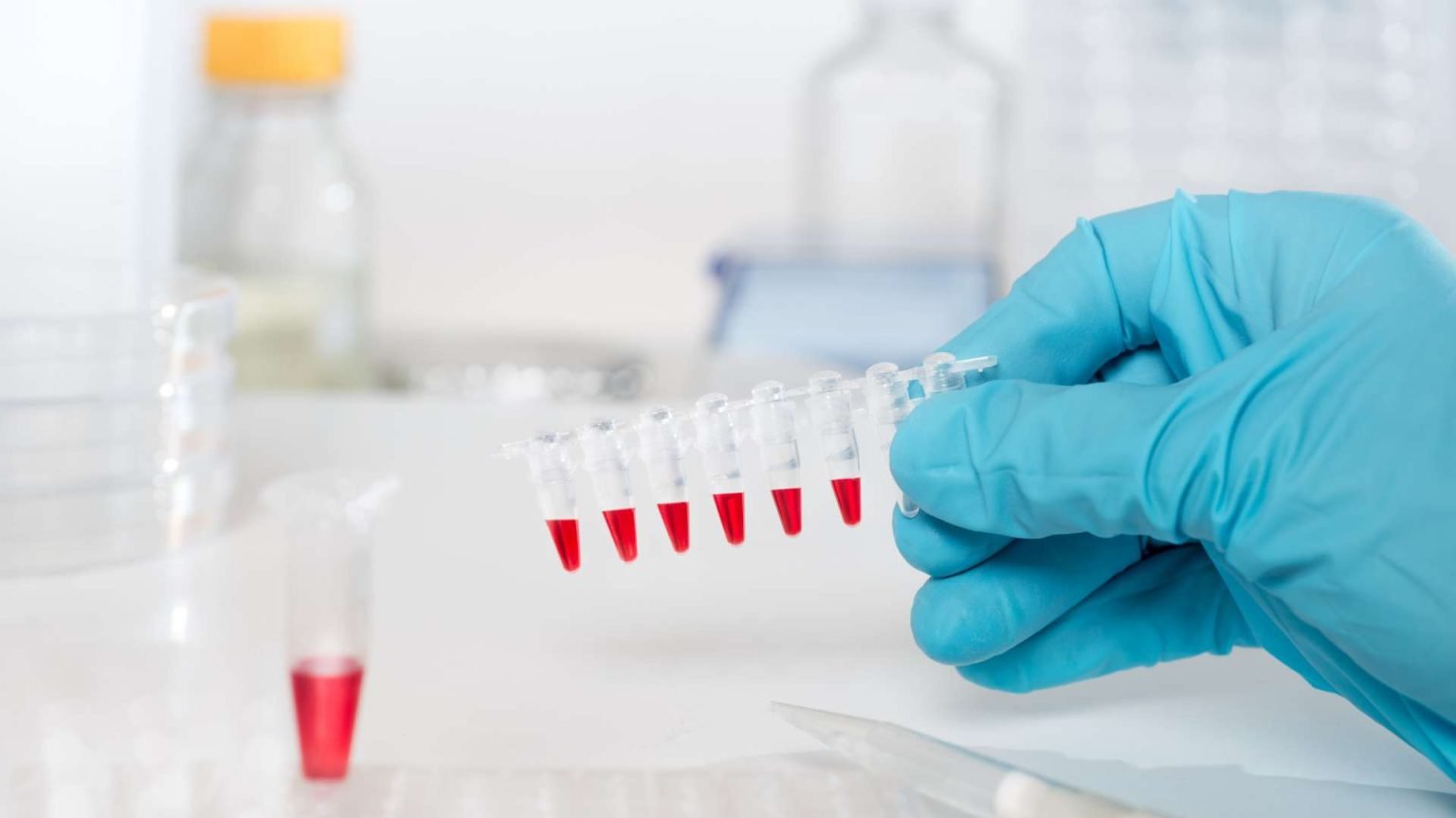 Pruebas ETS - Laboratorios Diama